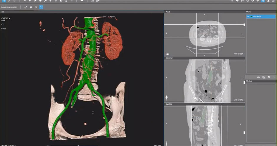 D2P (DICOM to Print) | 3D Systems